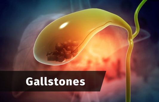 How To Get Gallbladder Stone Treatment At Home – Yogveda Healthcare