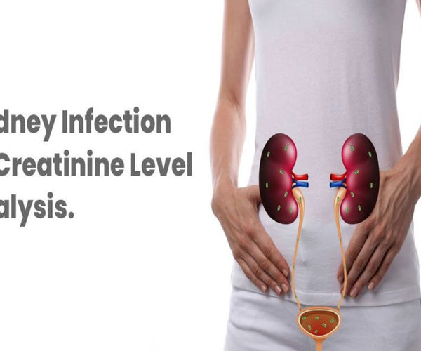 Understanding Blood Creatinine Levels and Dialysis – Yogveda Healthcare