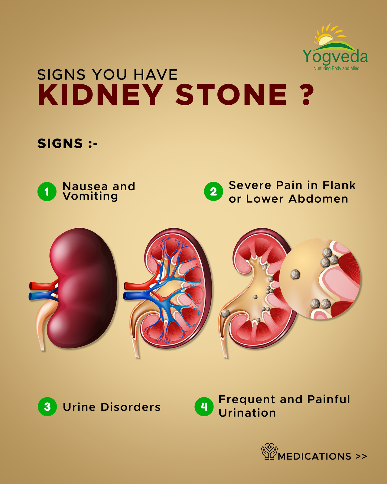 Kidney Stone Ayurvedic Treatment | Natural Medicine 100% – Yogveda ...